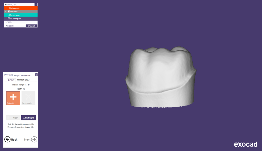 Burs for emax Premium Crown Preparation Set by prof. Dr Zavadka ...